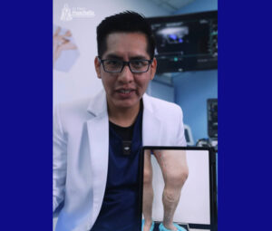 What Are Truncal Varicose Veins and Why Should You Treat Them?